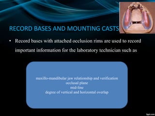 Lab procedures in fabrication of CPD- Dr Prathibha | PPTX
