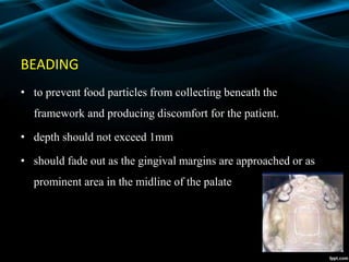 Lab procedures in fabrication of CPD- Dr Prathibha | PPTX