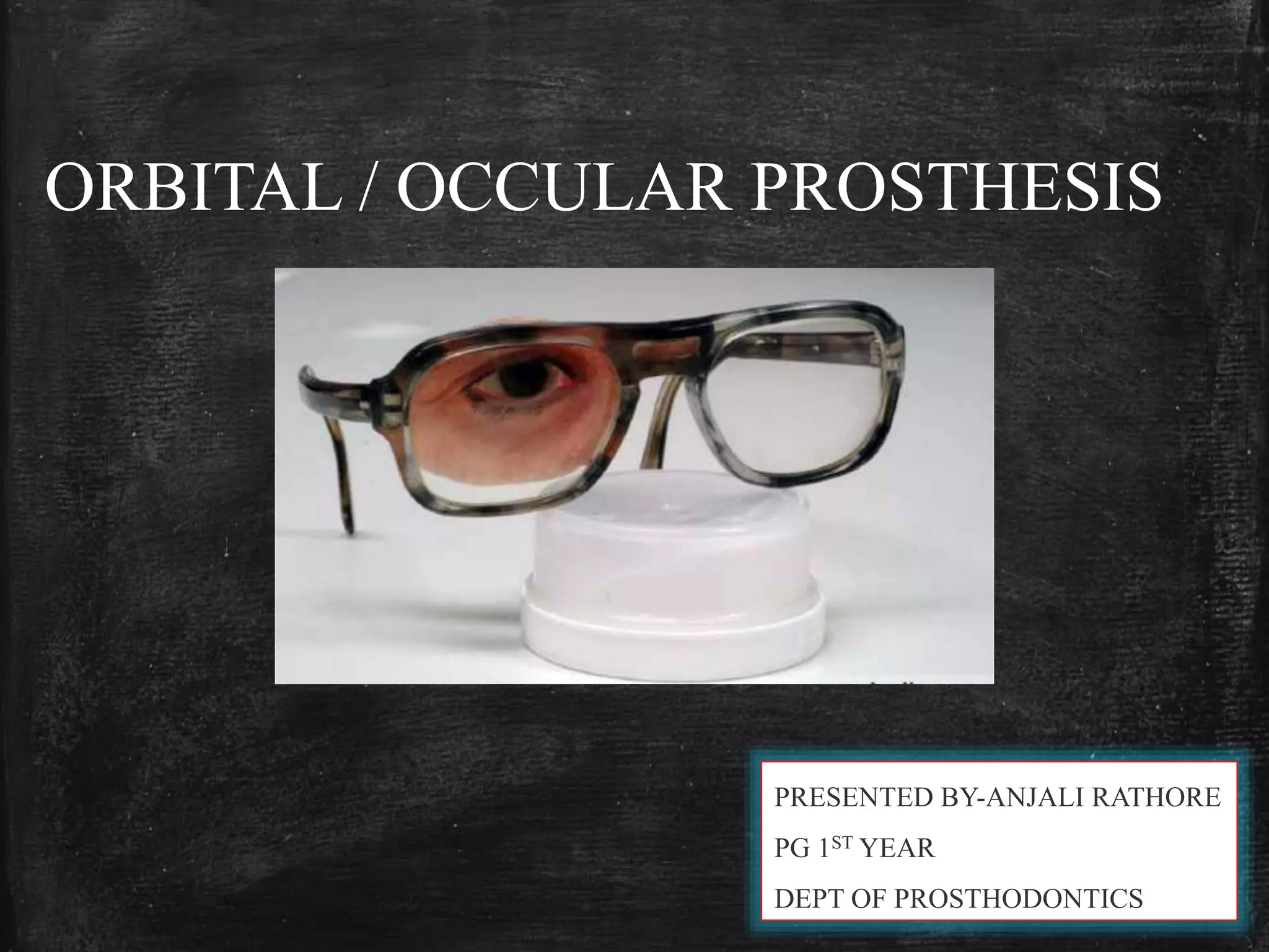 Ocular and Orbital prosthesis ANJALI RATHORE | PPTX