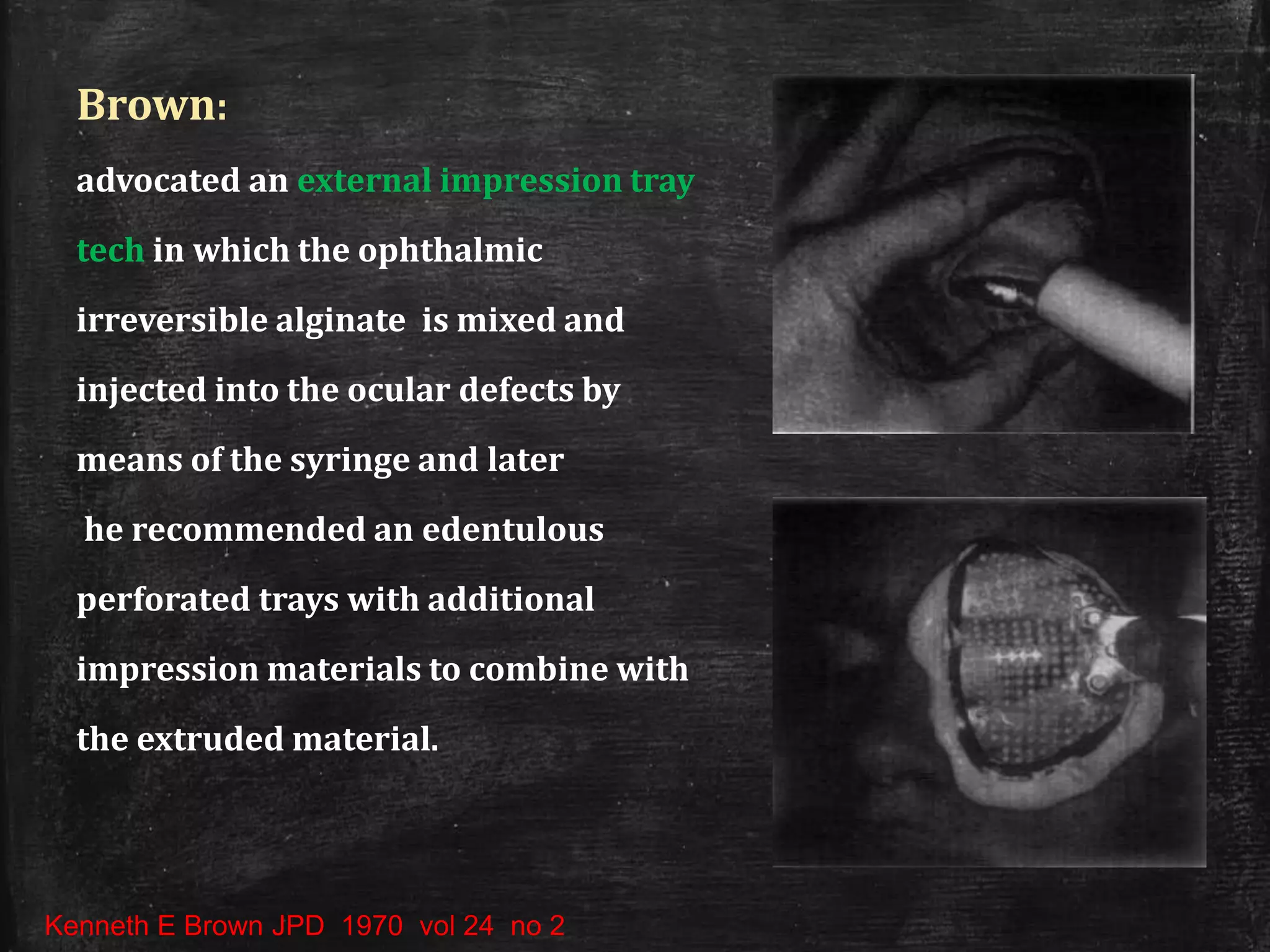 Ocular and Orbital prosthesis ANJALI RATHORE | PPTX