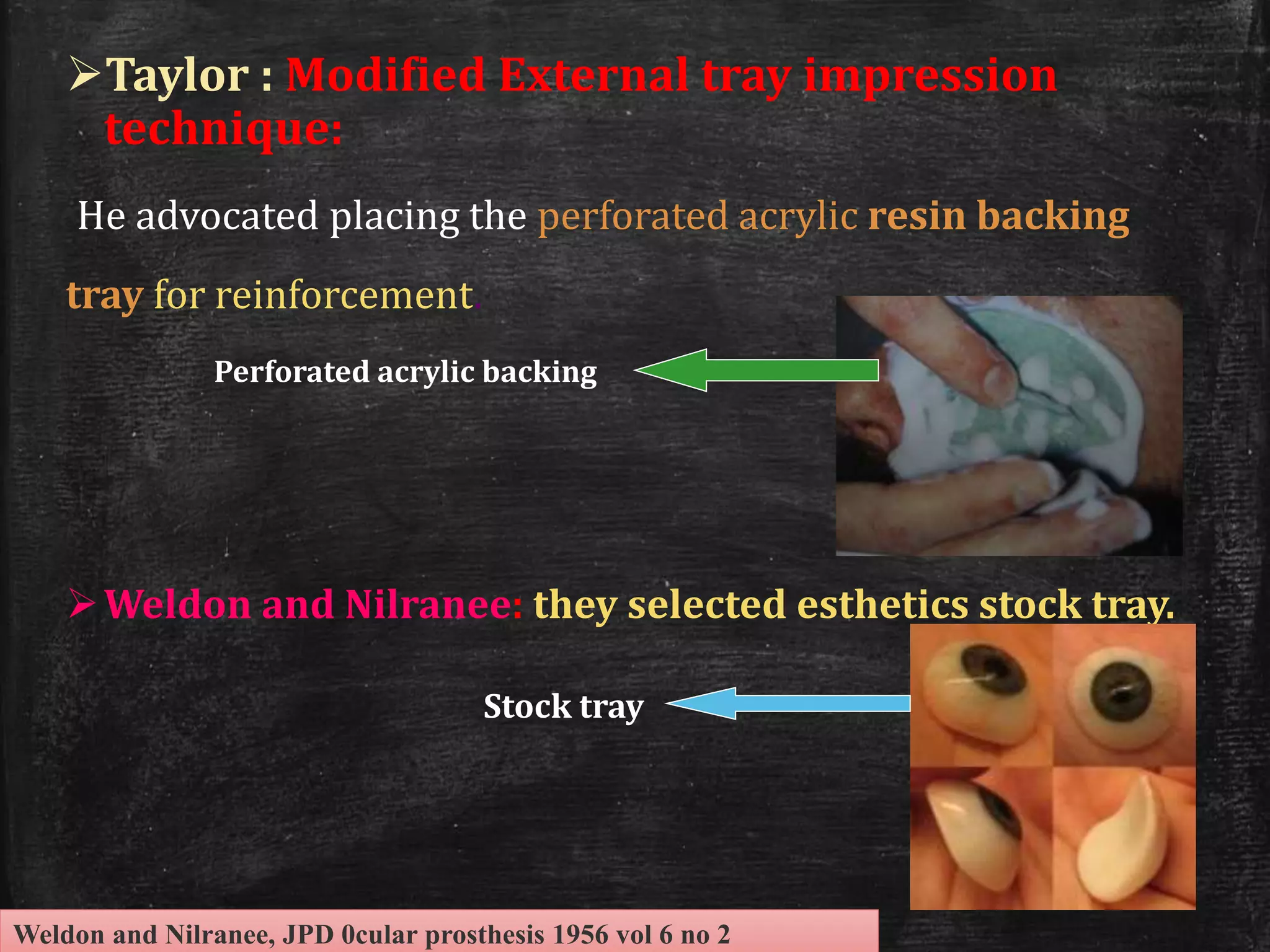Ocular and Orbital prosthesis ANJALI RATHORE | PPTX