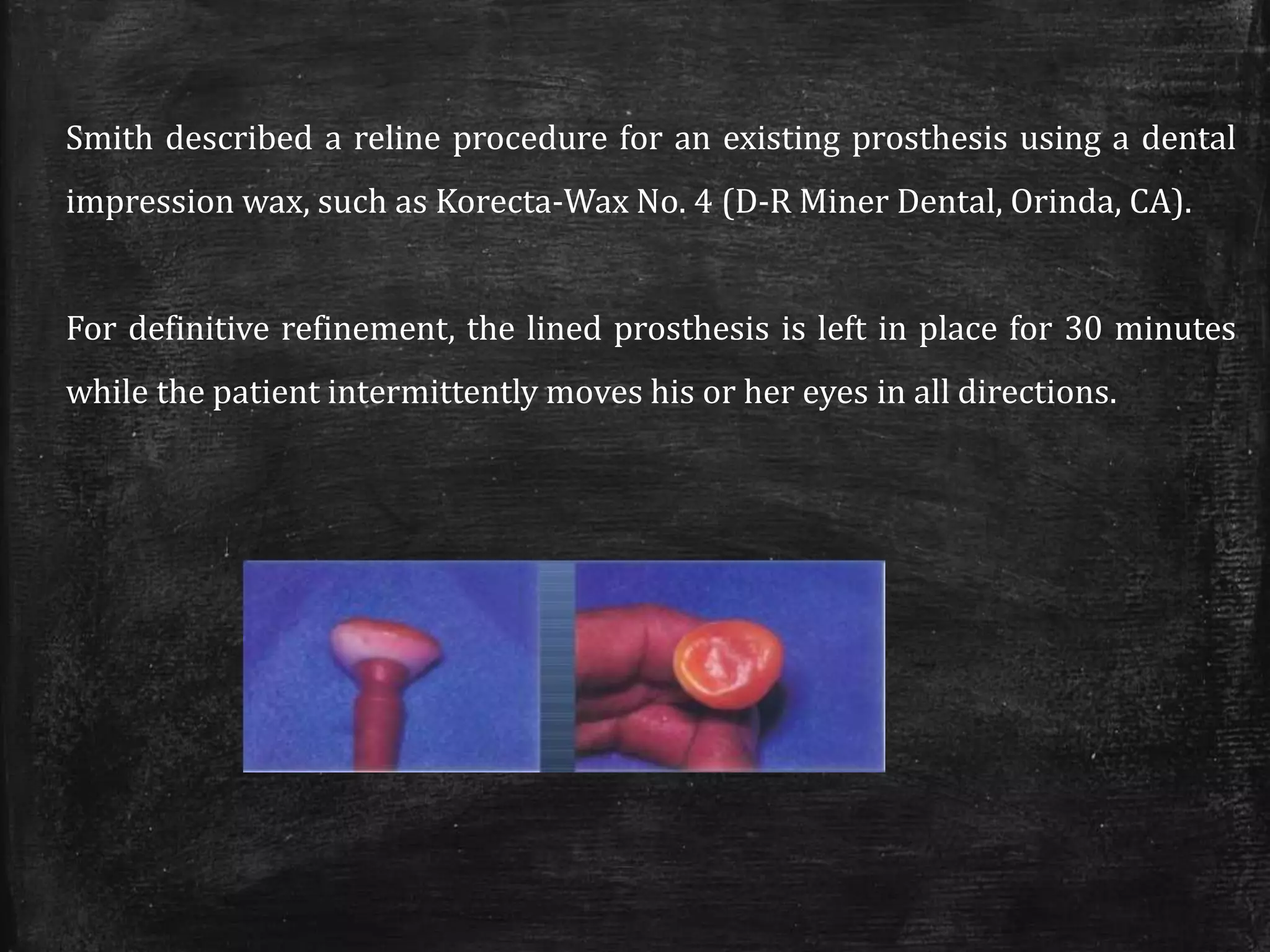 Ocular and Orbital prosthesis ANJALI RATHORE | PPTX