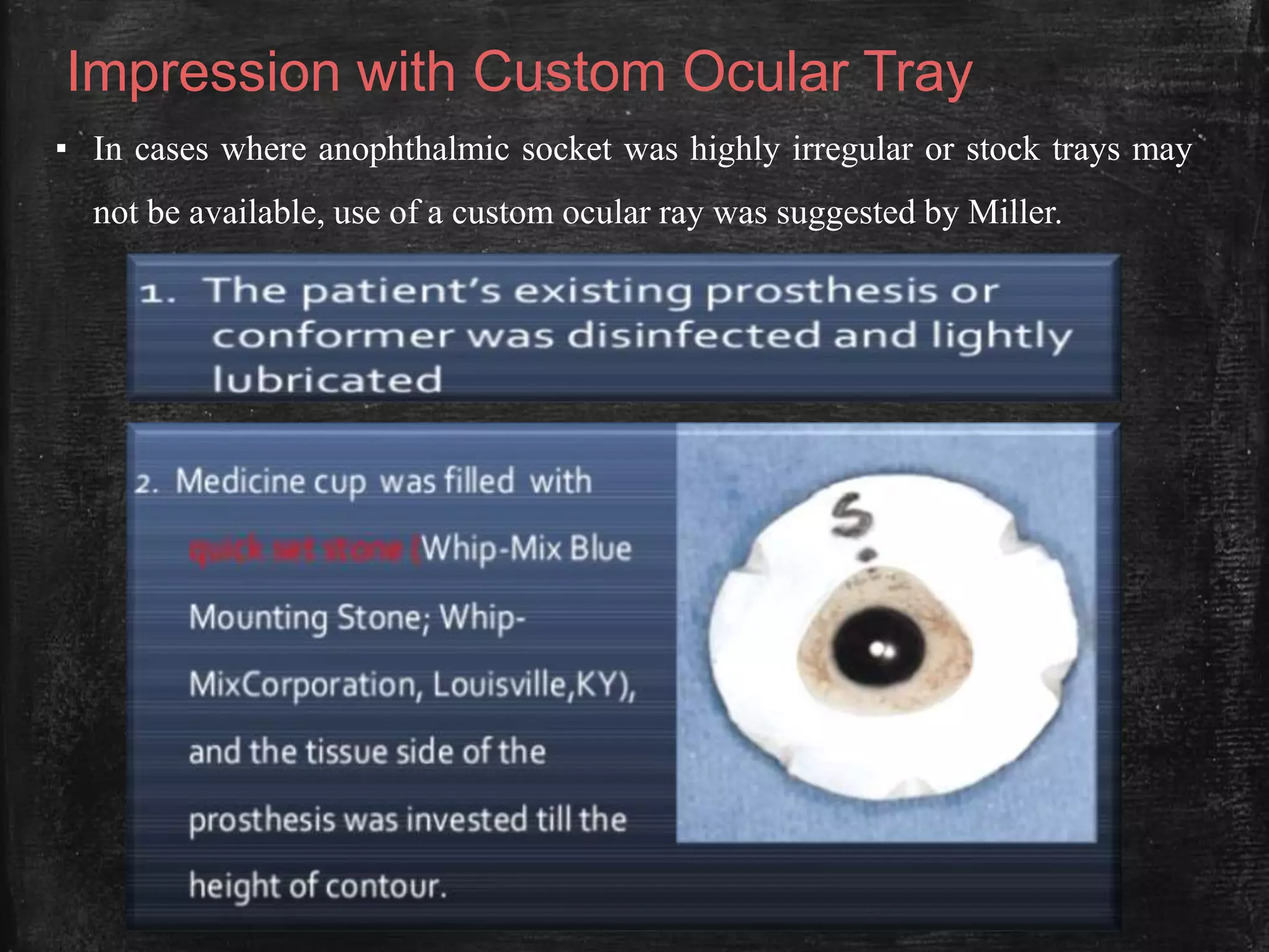 Ocular and Orbital prosthesis ANJALI RATHORE | PPTX