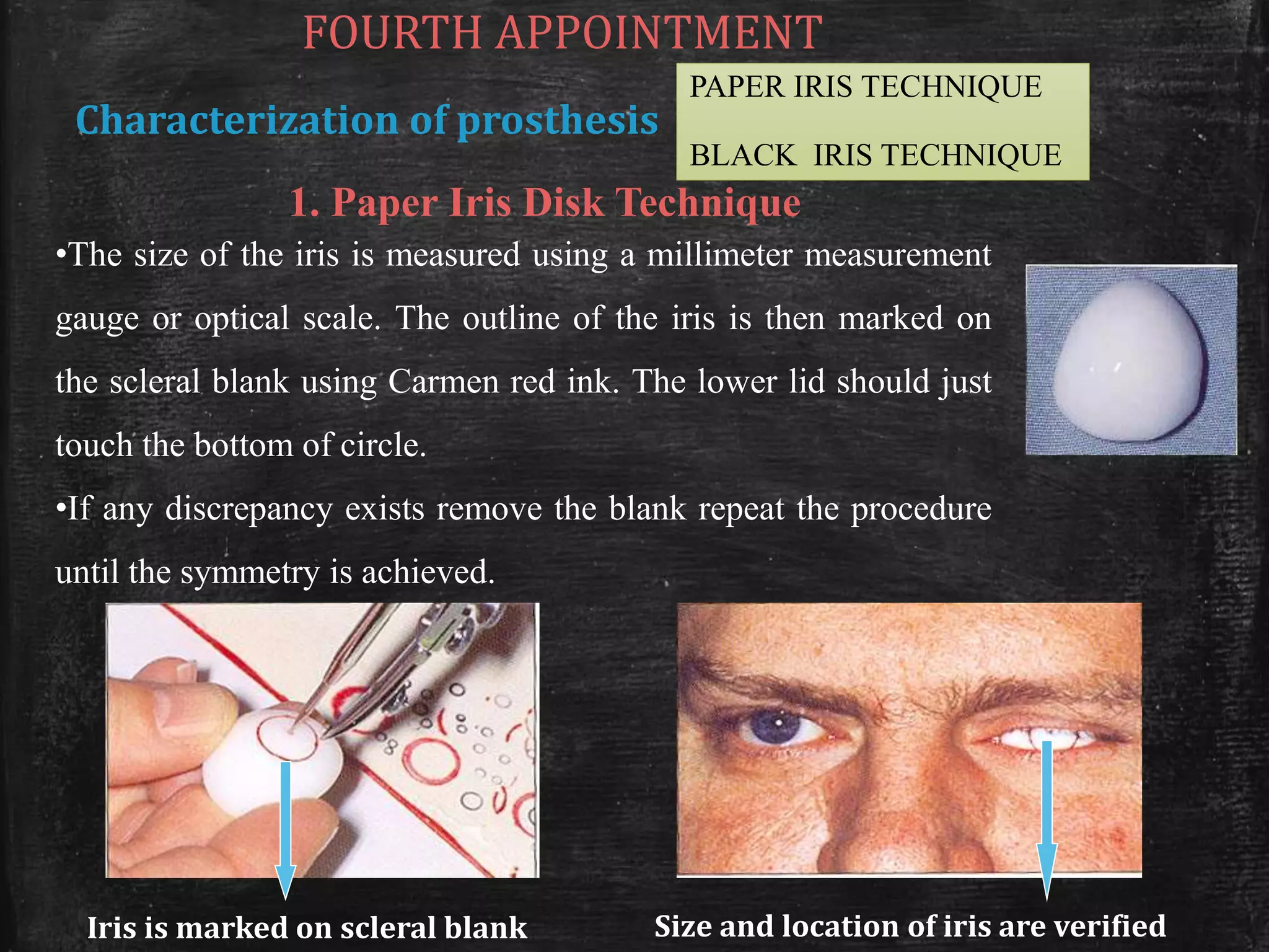 Ocular and Orbital prosthesis ANJALI RATHORE | PPTX