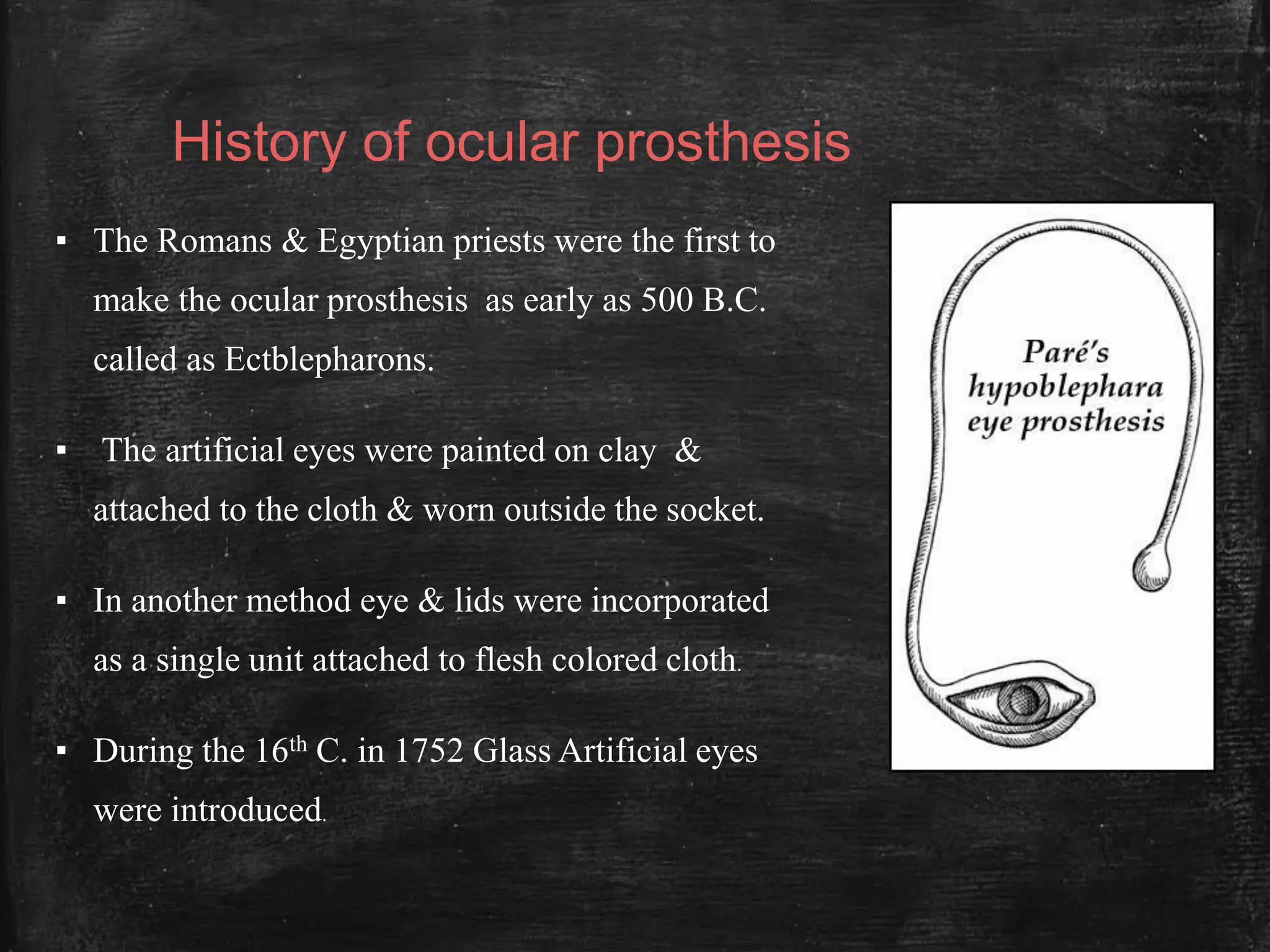 Ocular and Orbital prosthesis ANJALI RATHORE | PPTX