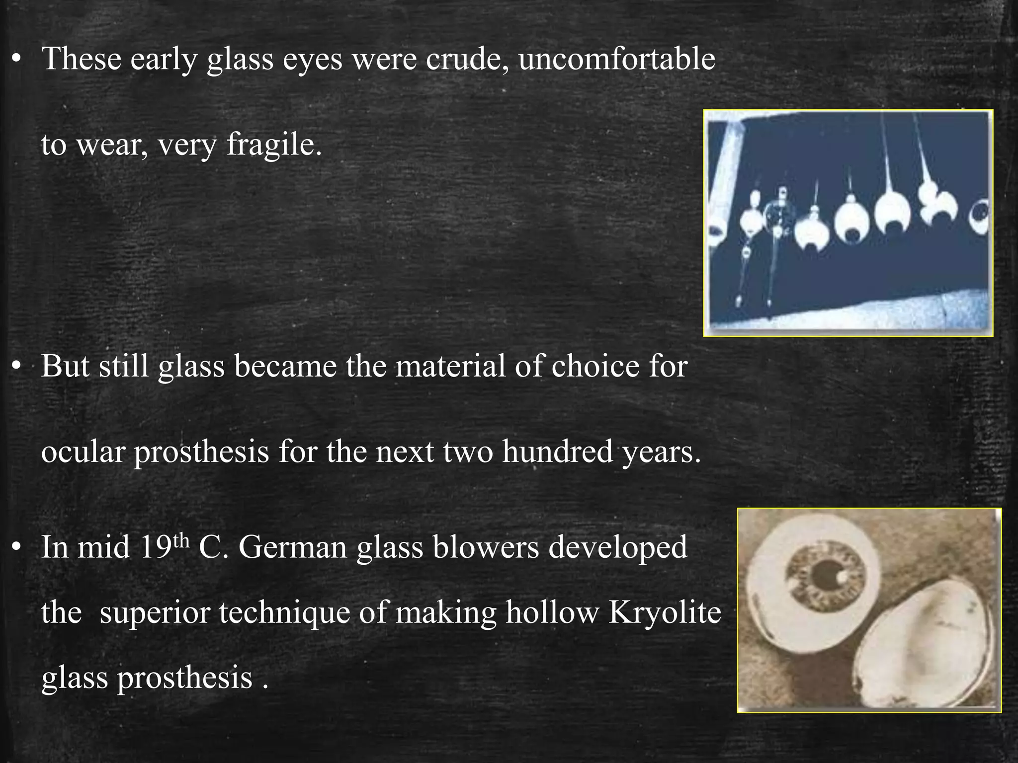 Ocular and Orbital prosthesis ANJALI RATHORE | PPTX