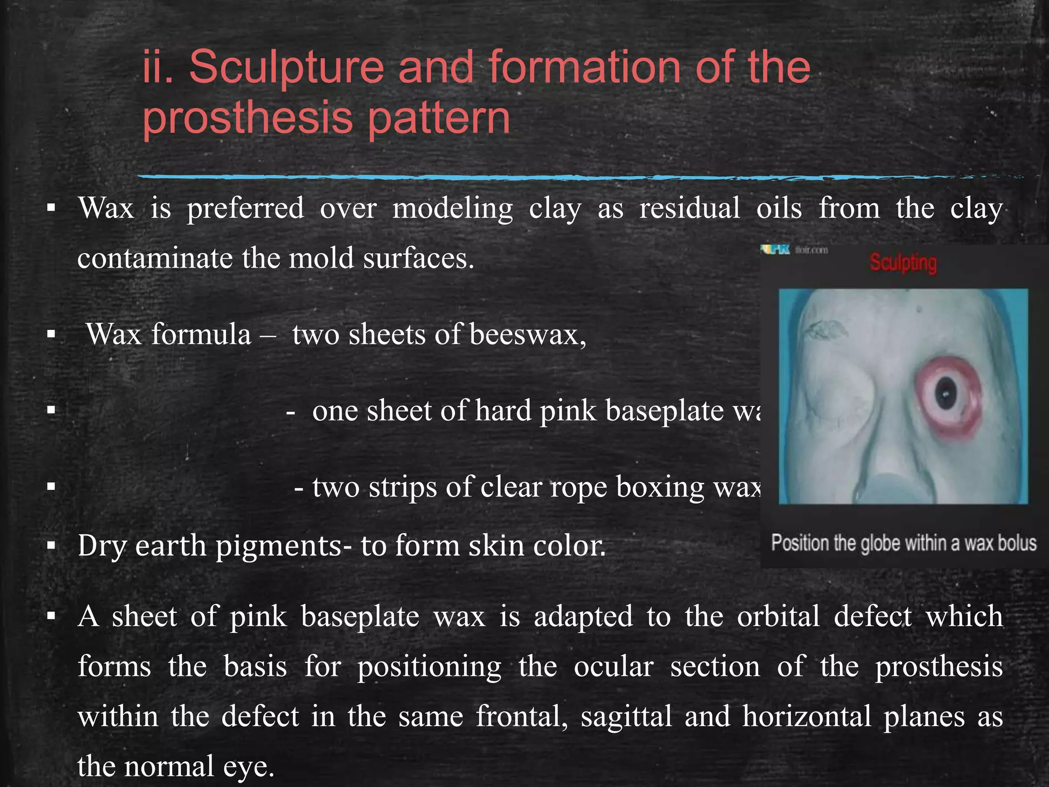Ocular and Orbital prosthesis ANJALI RATHORE | PPTX