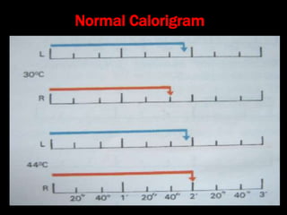 5. routine clinical tests of vestibular function kk | PPT