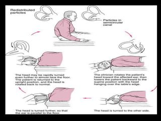 5. routine clinical tests of vestibular function kk | PPT