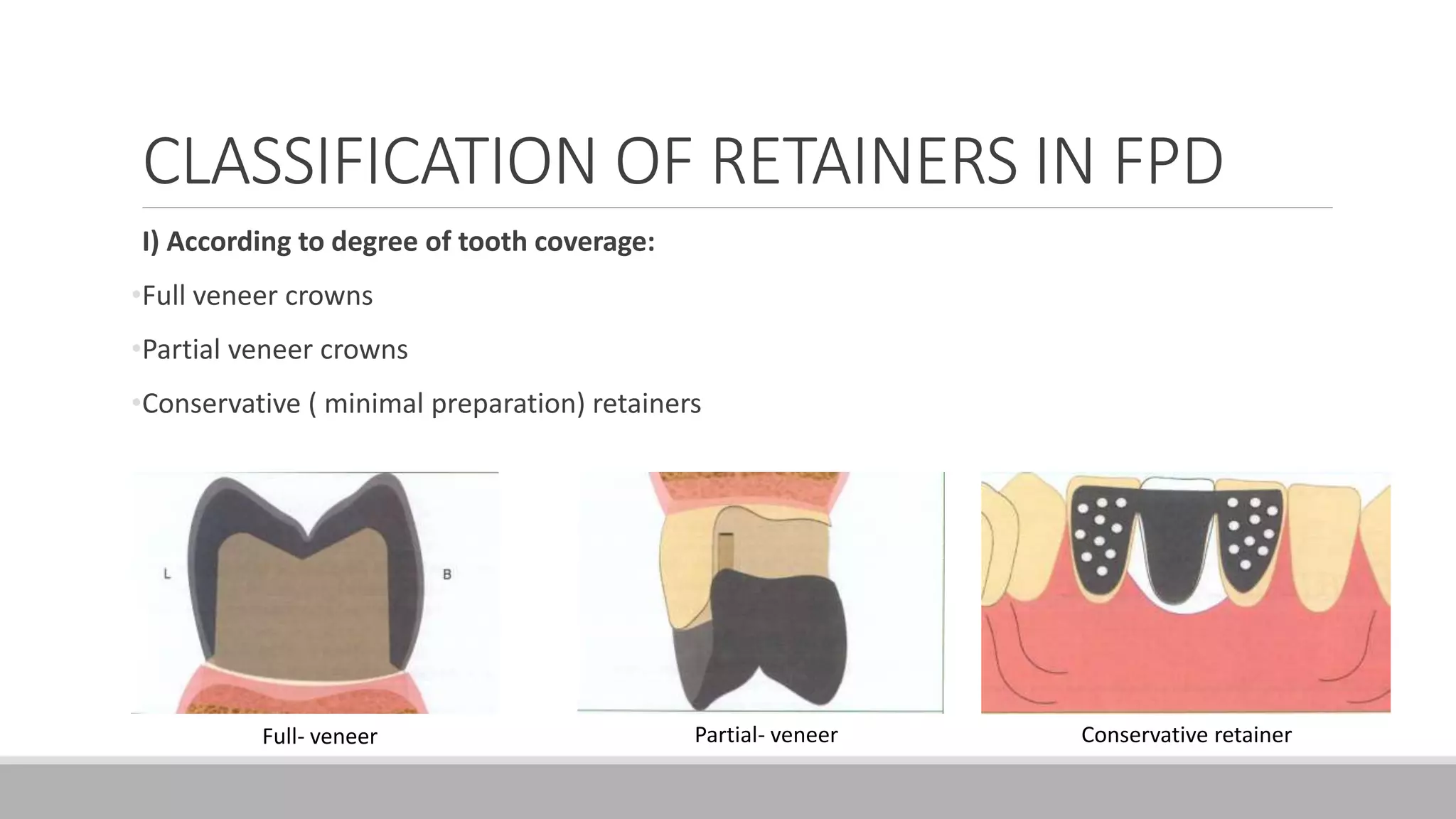 COMPONENTS OF FIXED PARTIAL DENTURE | PPTX