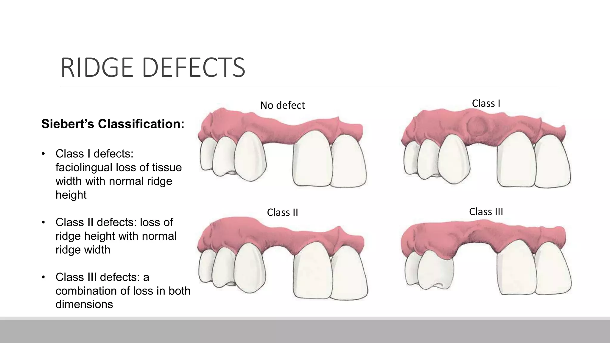 COMPONENTS OF FIXED PARTIAL DENTURE | PPTX