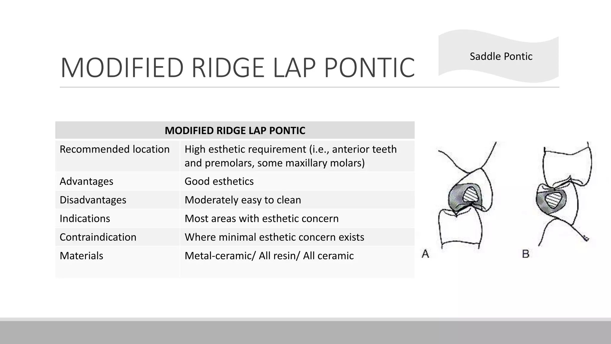COMPONENTS OF FIXED PARTIAL DENTURE | PPTX