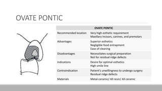 COMPONENTS OF FIXED PARTIAL DENTURE | PPTX