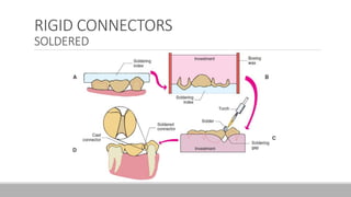 COMPONENTS OF FIXED PARTIAL DENTURE | PPTX