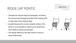 COMPONENTS OF FIXED PARTIAL DENTURE | PPTX