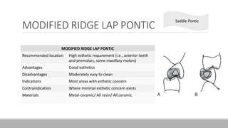 COMPONENTS OF FIXED PARTIAL DENTURE | PPTX