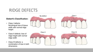 COMPONENTS OF FIXED PARTIAL DENTURE | PPT