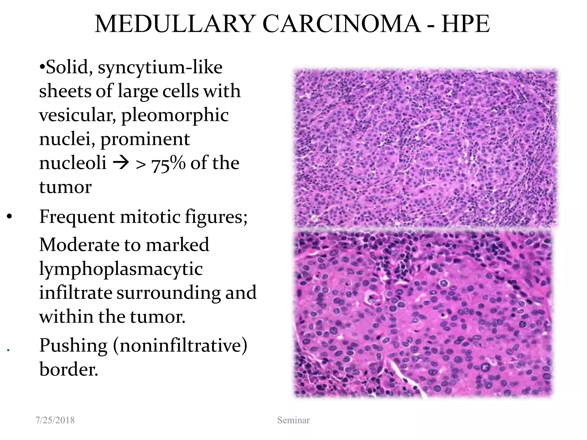 5. breast carcinoma histopathology types and clinical features | PPTX