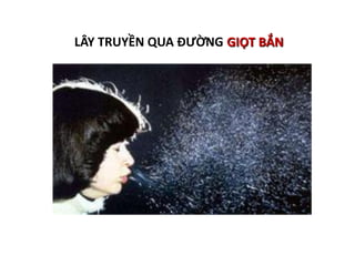 Bệnh quai bị - 2019 - Đại học Y dược TPHCM | PDF