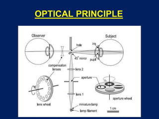Ophthalmoscopy | PPT