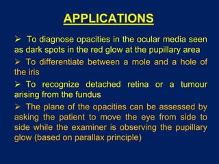 Ophthalmoscopy | PPT
