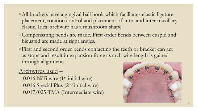 Leveling and Aligning | PPTX