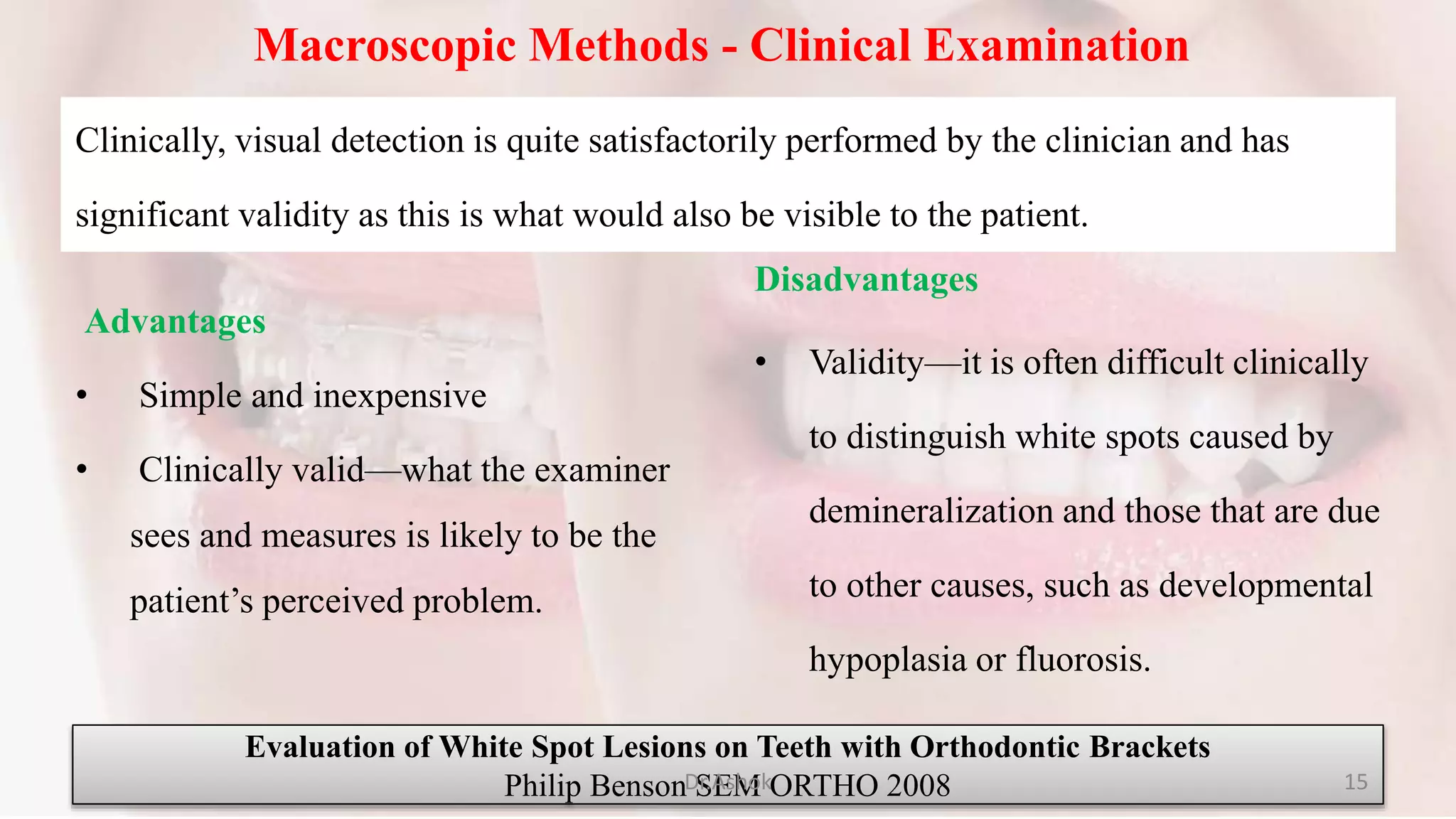 white spot lesion - prevention and management | PPTX