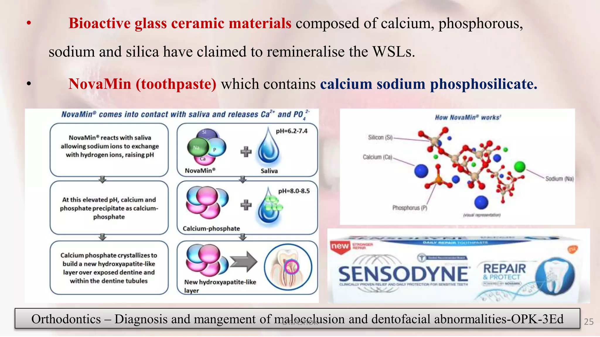 white spot lesion - prevention and management | PPTX
