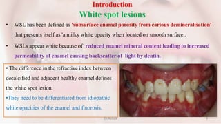white spot lesion - prevention and management | PPTX