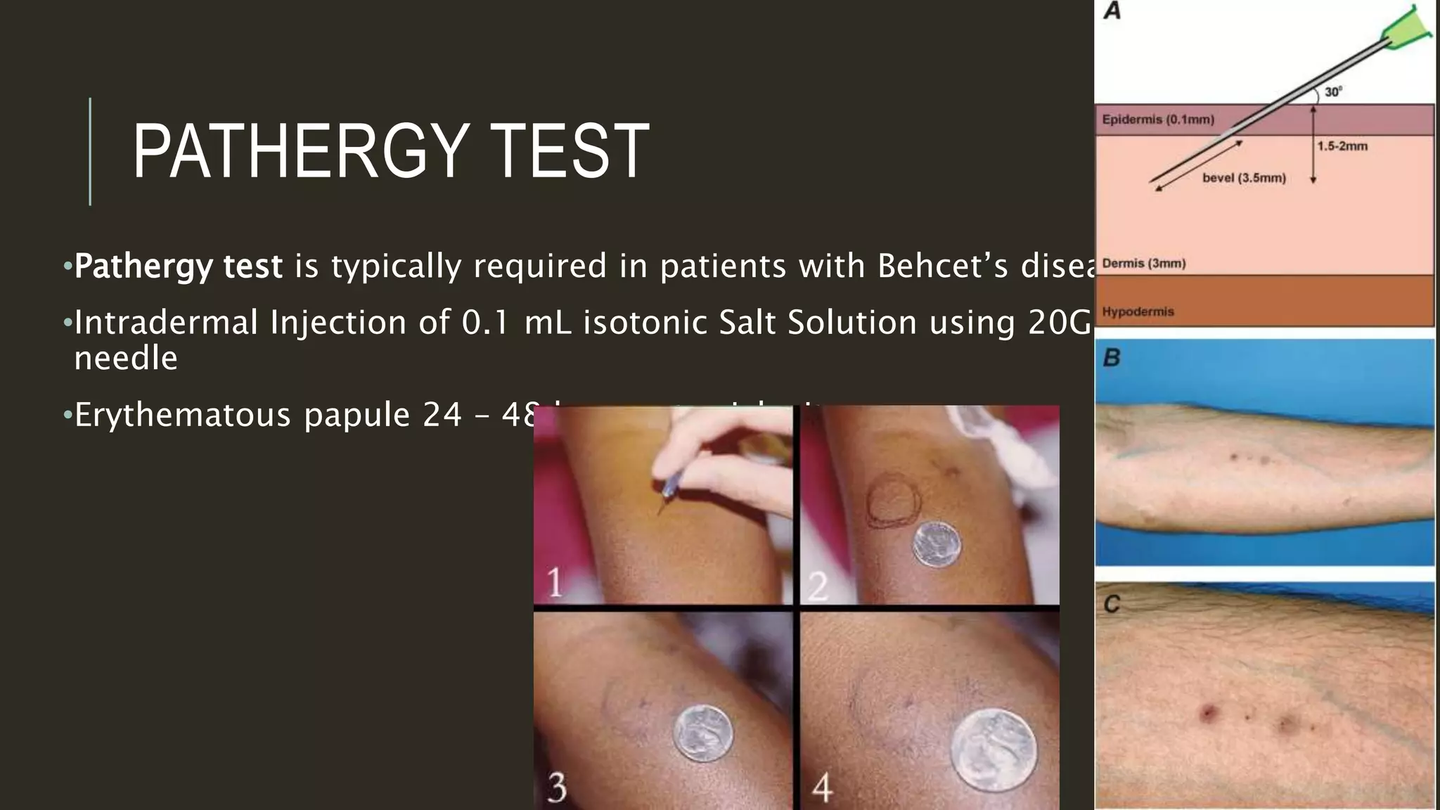 Oral Ulceration | PPTX