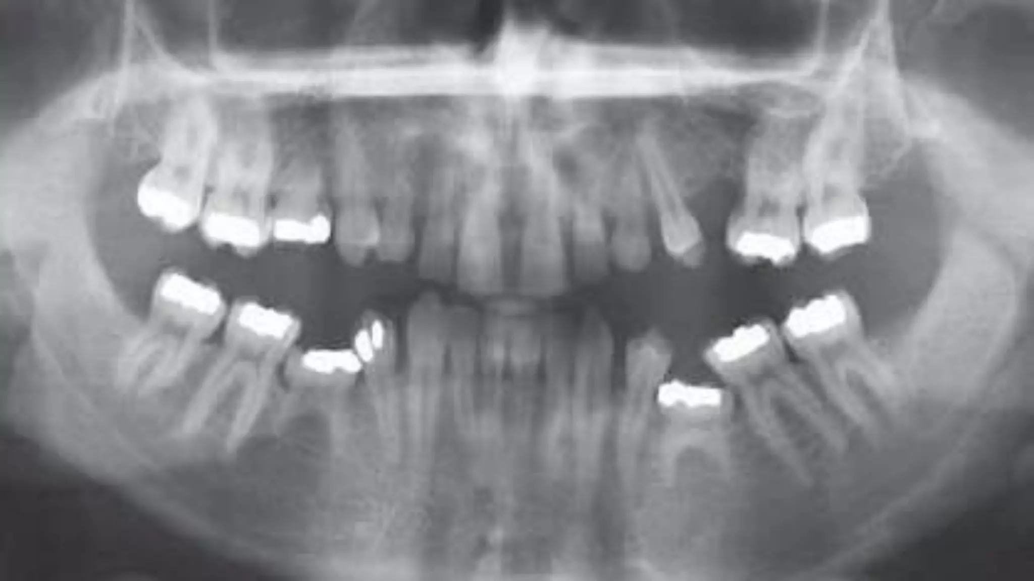 Radiographic Interpretation of Dental Anomalies | PPTX