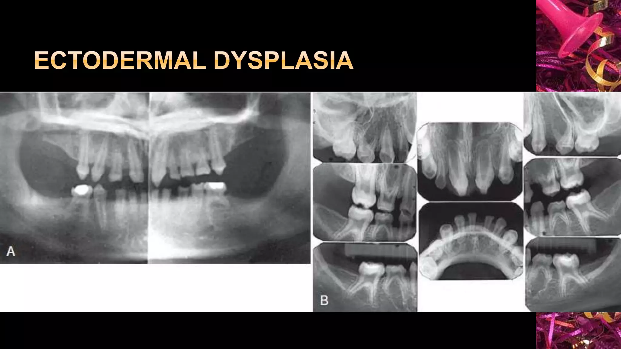 Radiographic Interpretation of Dental Anomalies | PPTX | Dental Health | Diseases and Conditions