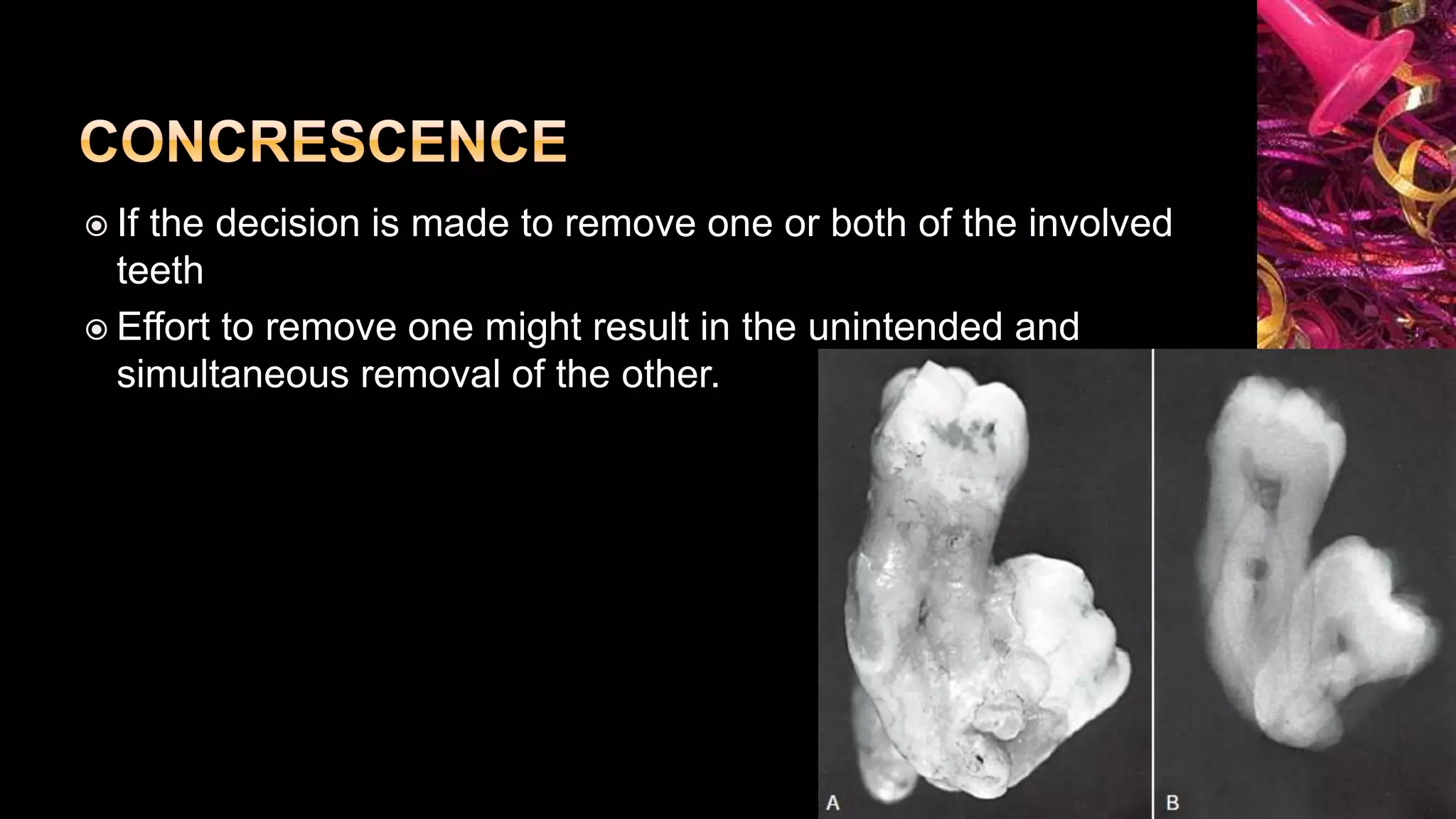 Radiographic Interpretation of Dental Anomalies | PPTX