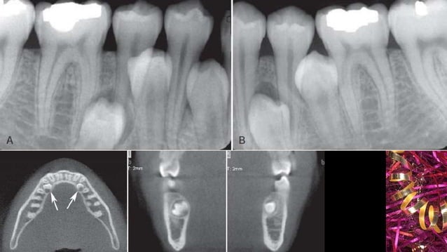 Radiographic Interpretation of Dental Anomalies | PPTX | Dental Health ...