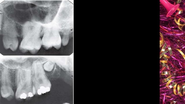 Radiographic Interpretation of Dental Anomalies | PPTX | Dental Health ...