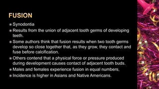 Radiographic Interpretation of Dental Anomalies | PPTX