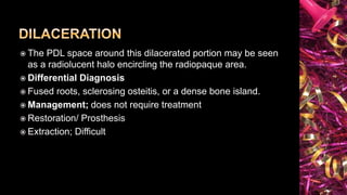 Radiographic Interpretation of Dental Anomalies | PPTX