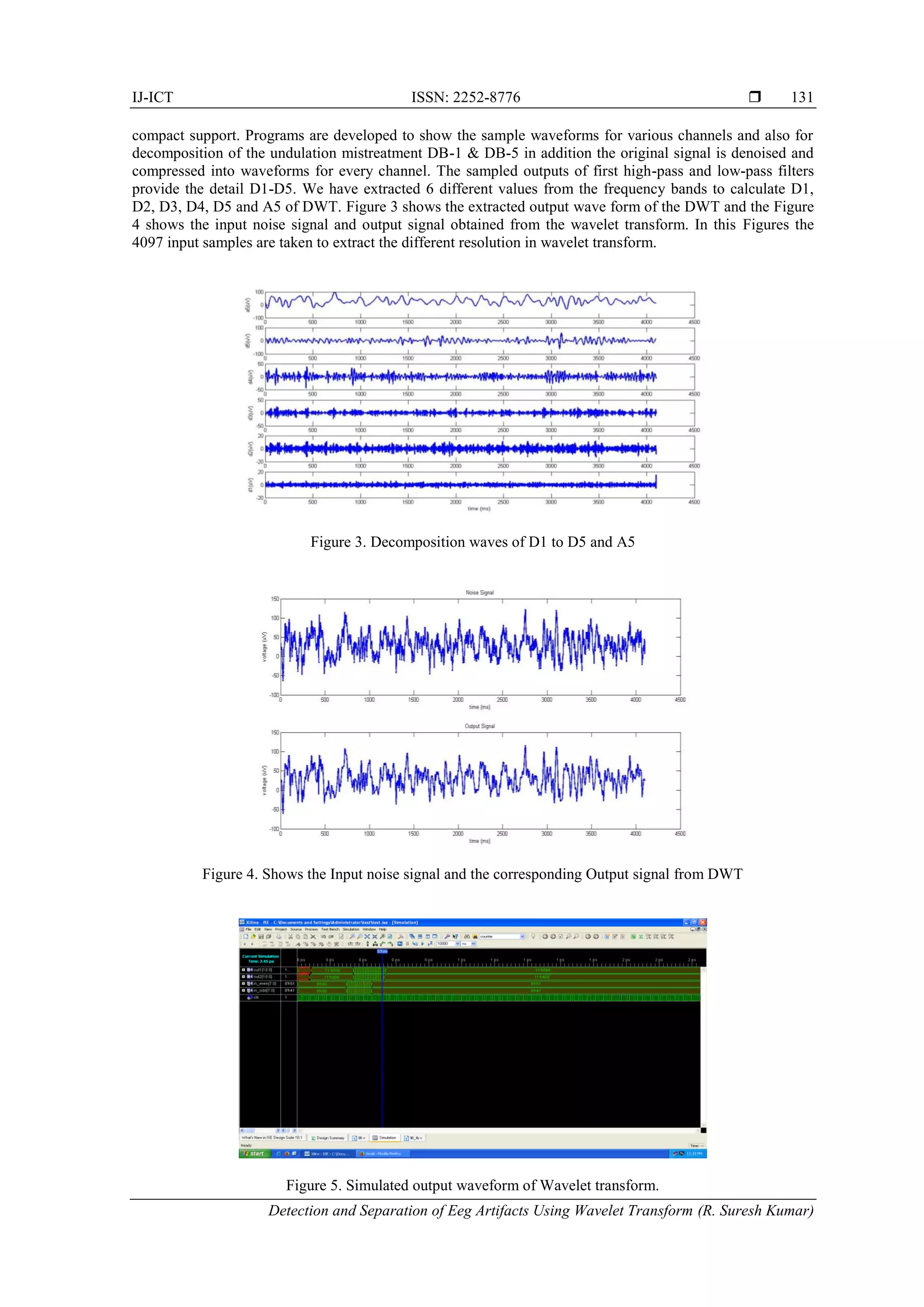 5 Detection And Separation Of Eeg Artifacts Using Wavelet Transform Nov 11 2017 Edit I Pdf