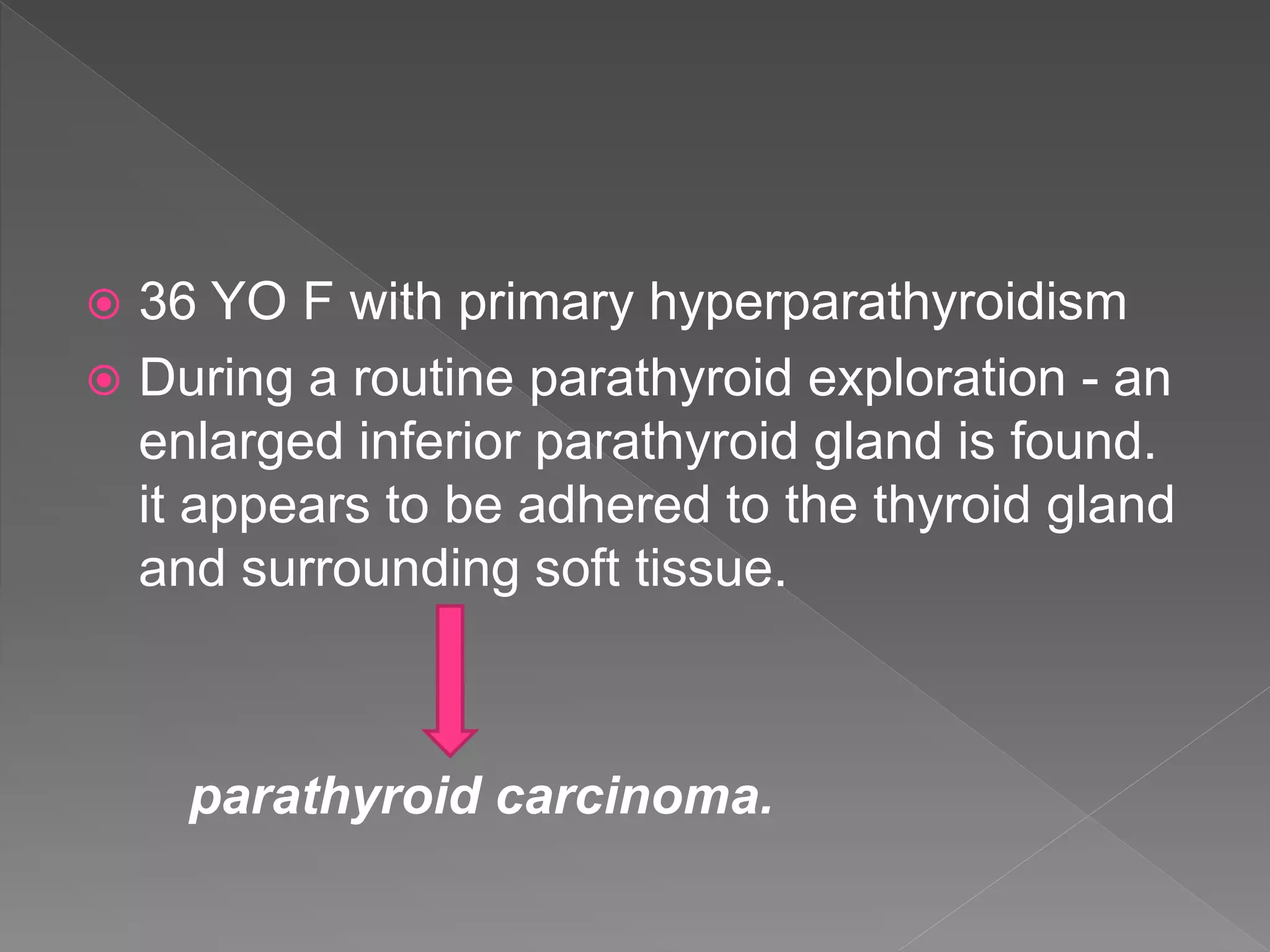 Hyperparathyroidism | PPT | Free Download
