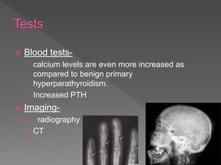 Hyperparathyroidism | PPTX