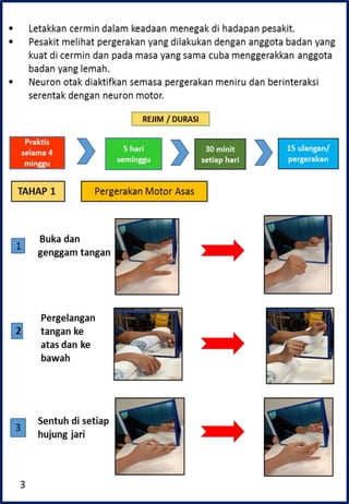 MIRROR BOX THERAPY | PDF