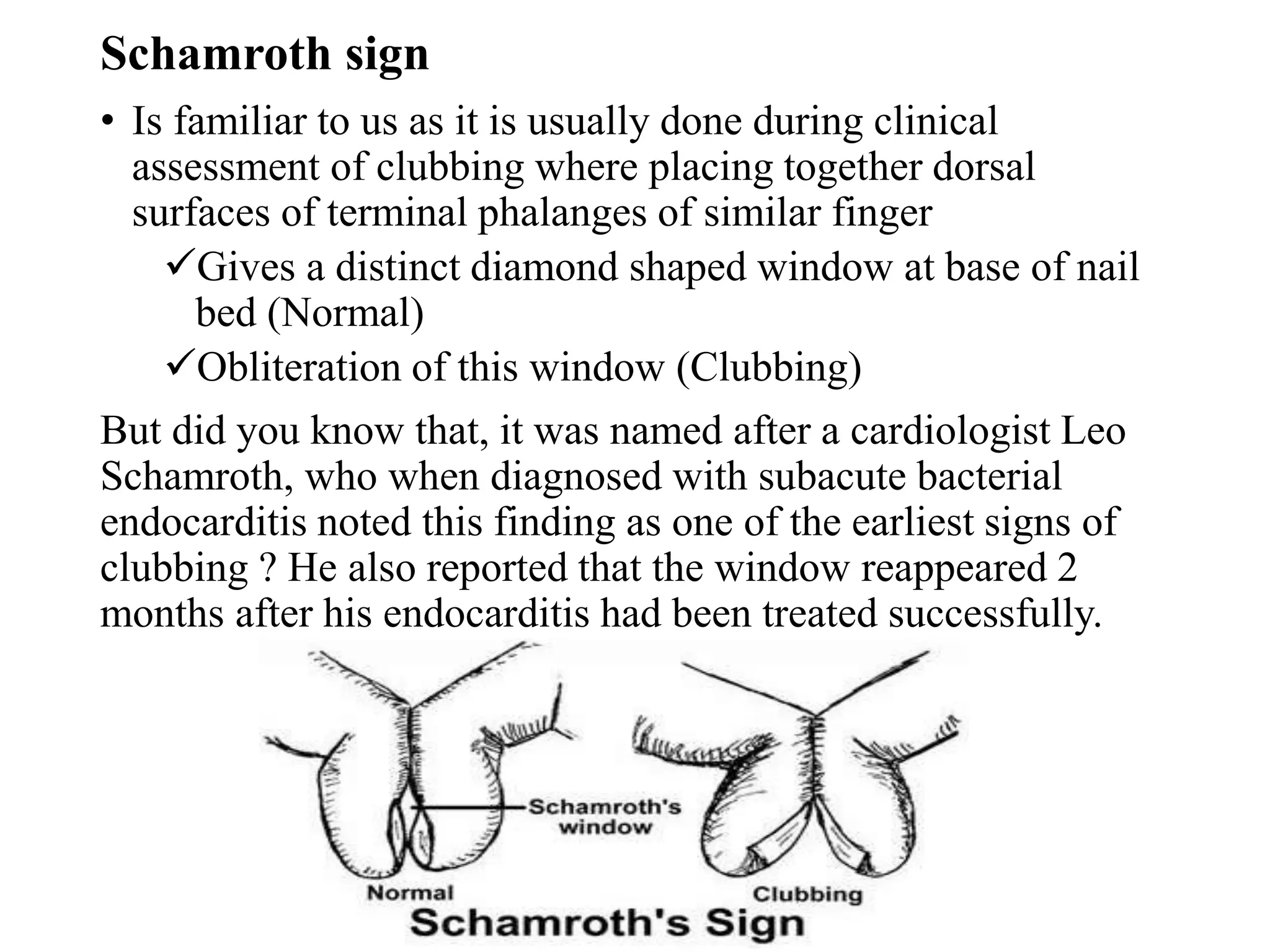 Physiological basis behind CLUBBING | PPTX