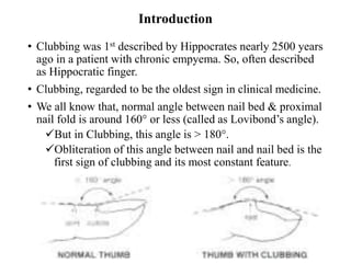 Physiological basis behind CLUBBING | PPT