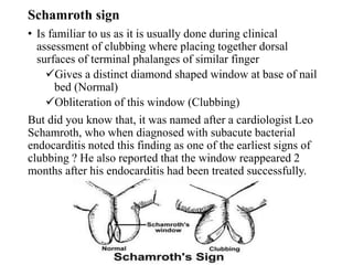 Physiological basis behind CLUBBING | PPT