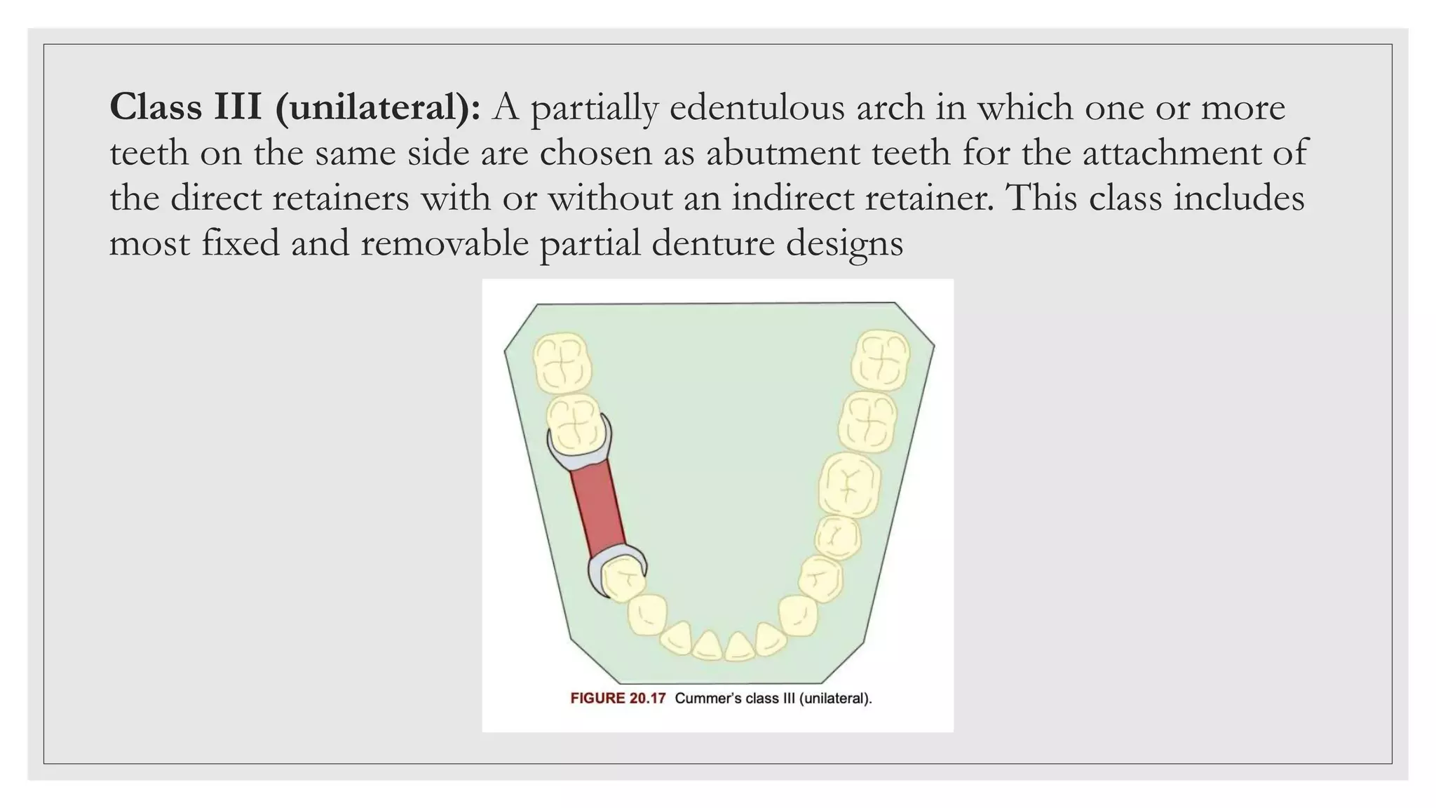 classification of partially edentulous arches | PPTX