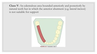 classification of partially edentulous arches | PPTX