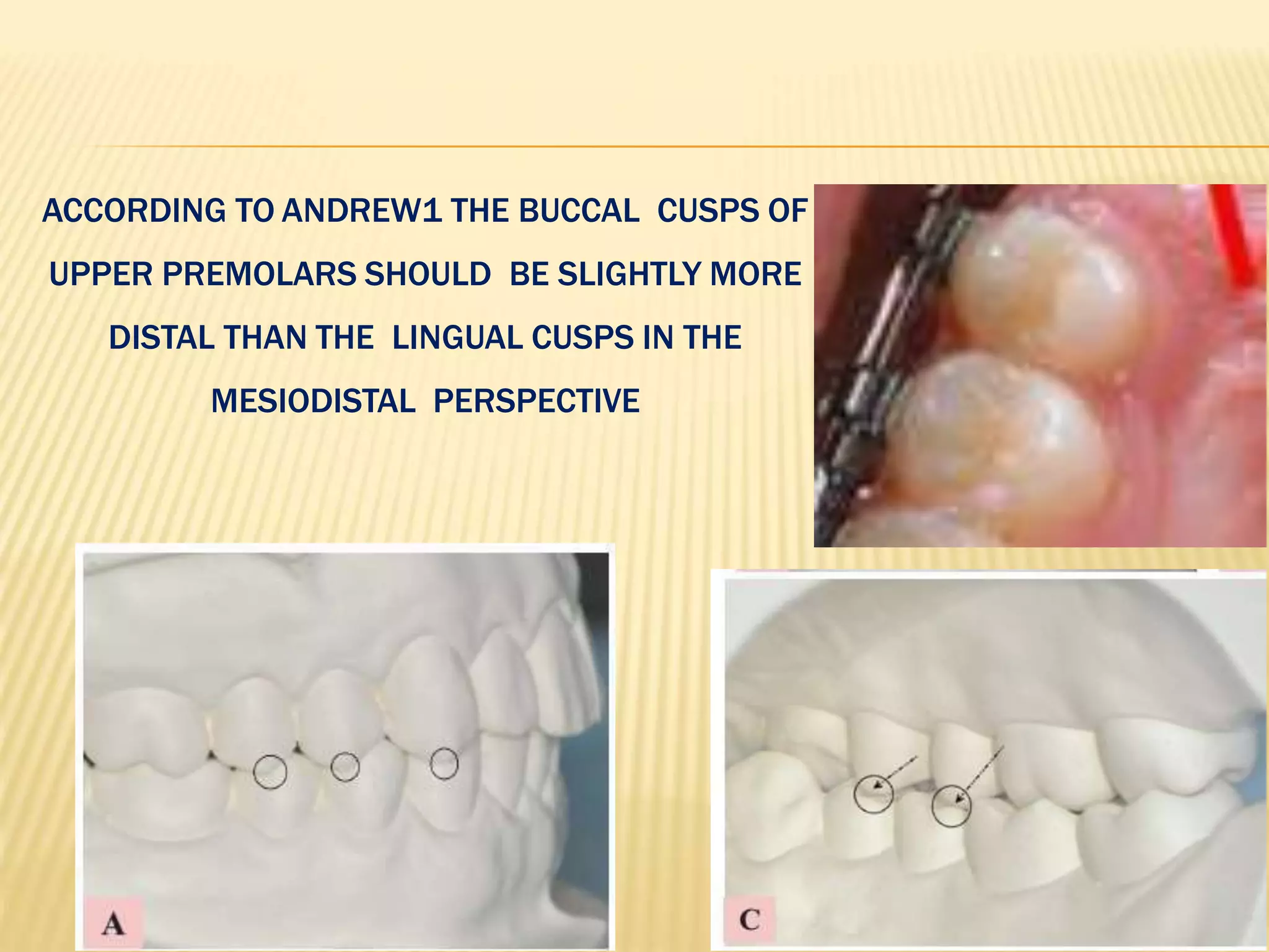 BRACKET PLACEMENT IN ORTHODONTIC BONDING | PPTX