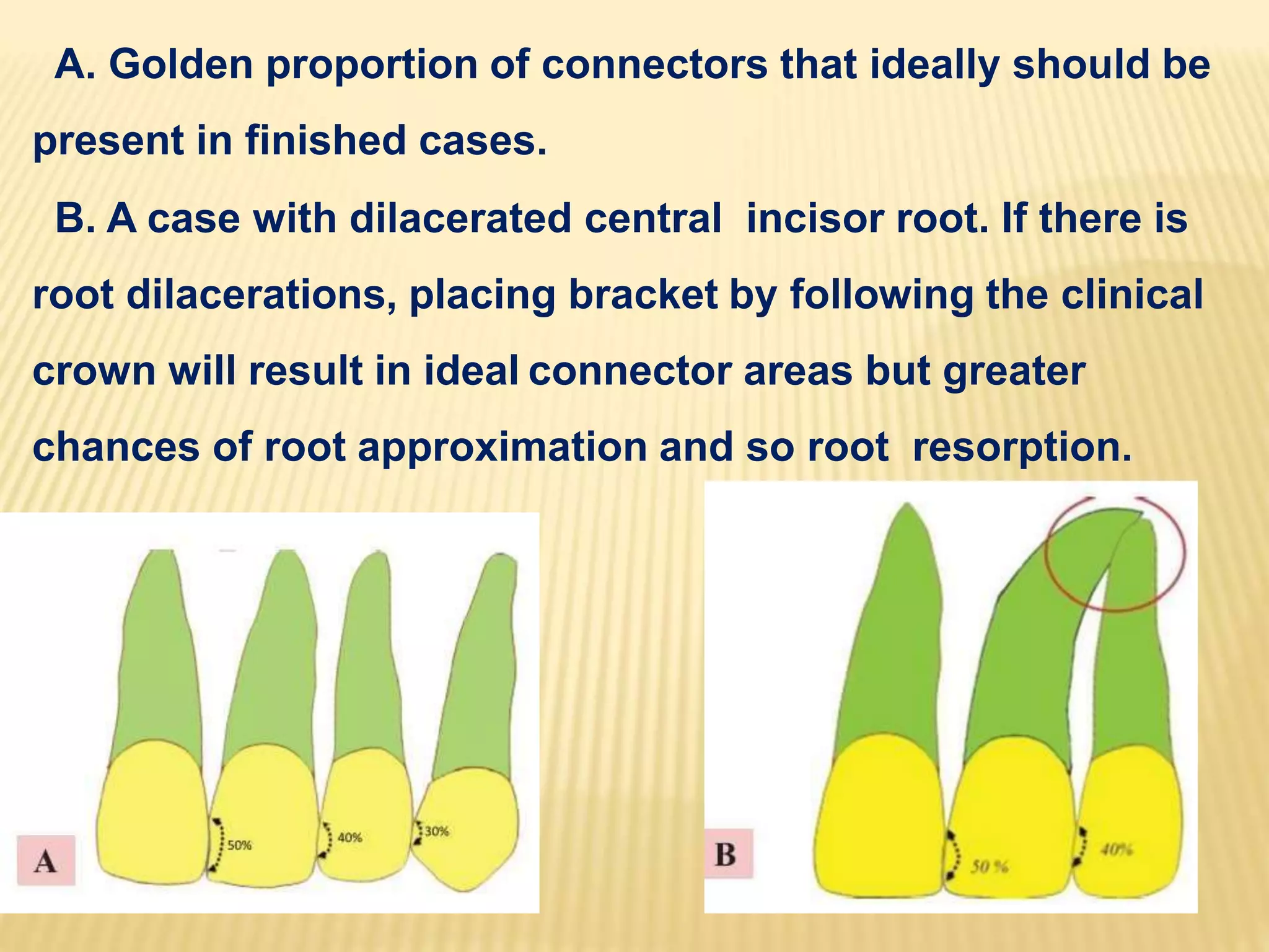BRACKET PLACEMENT IN ORTHODONTIC BONDING | PPTX