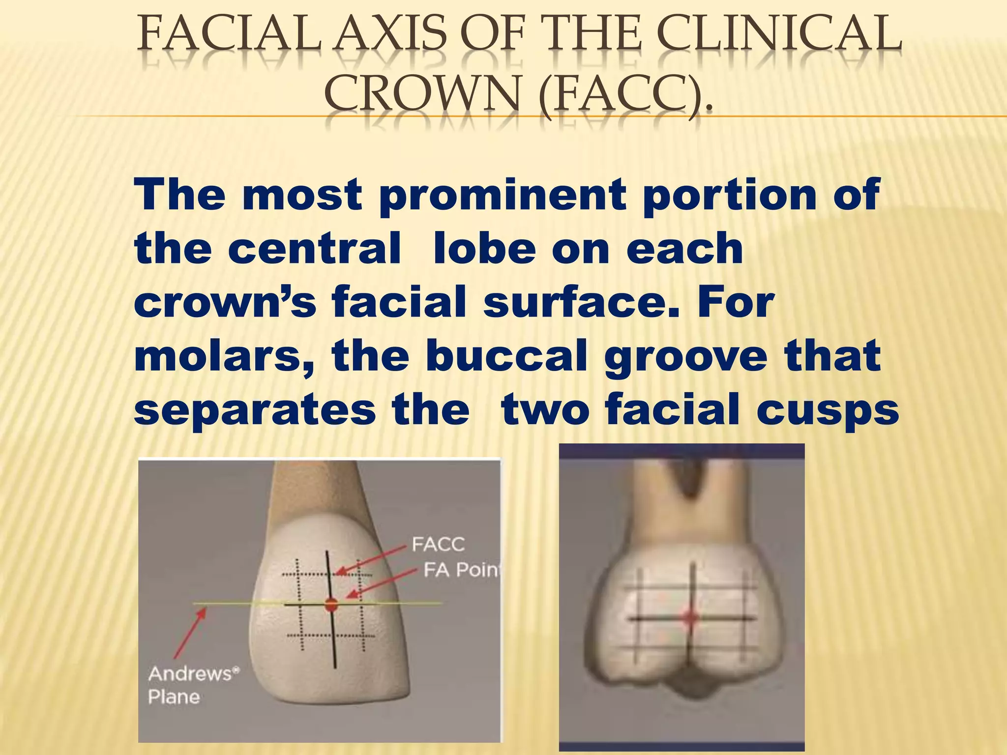BRACKET PLACEMENT IN ORTHODONTIC BONDING | PPTX