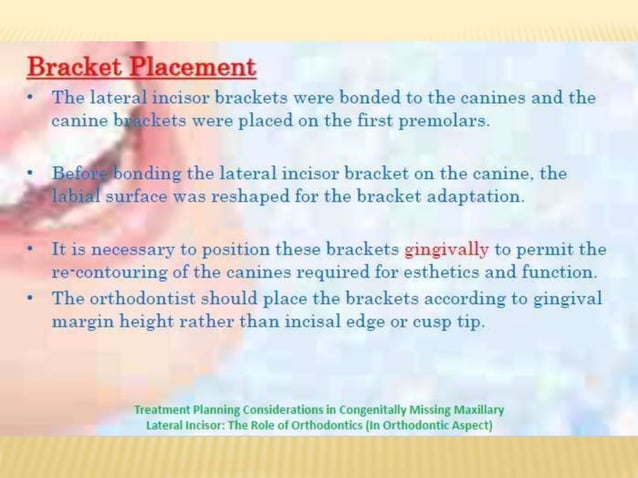 BRACKET PLACEMENT IN ORTHODONTIC BONDING | PPTX